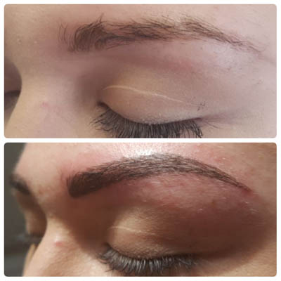 Microblading before & after photos - Redeem clinic - Yorkshire